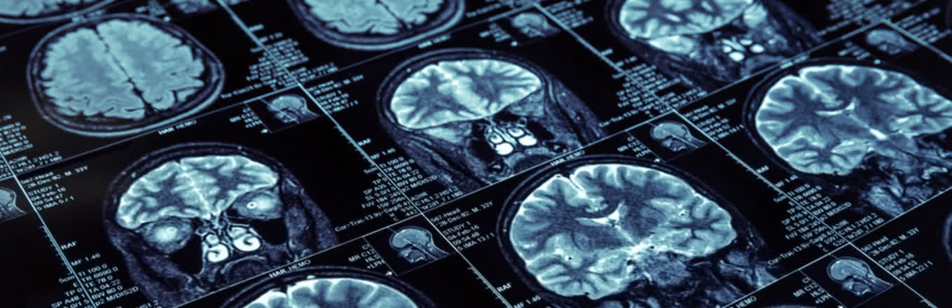 Intelligenz: Was ist das genau? | NeuroNation